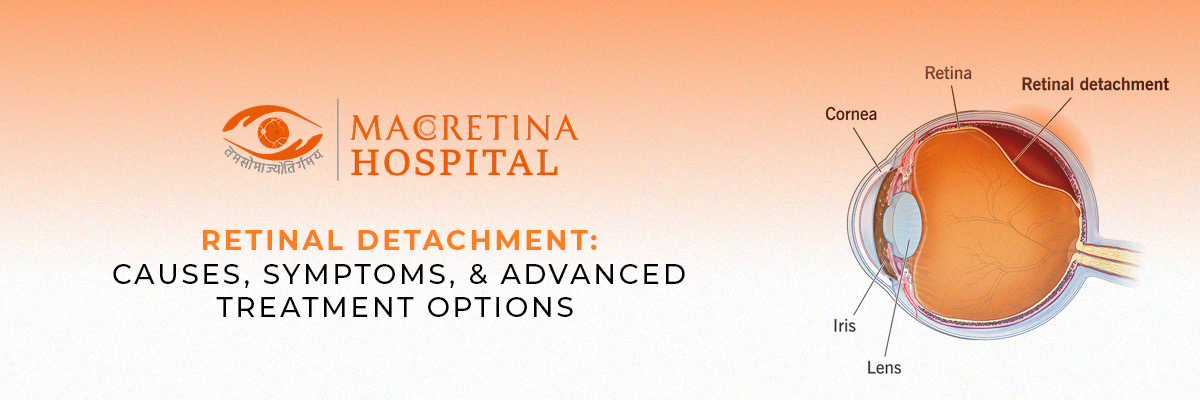 Retinal Detachment: Causes, Symptoms, and Advanced Treatment Options ...