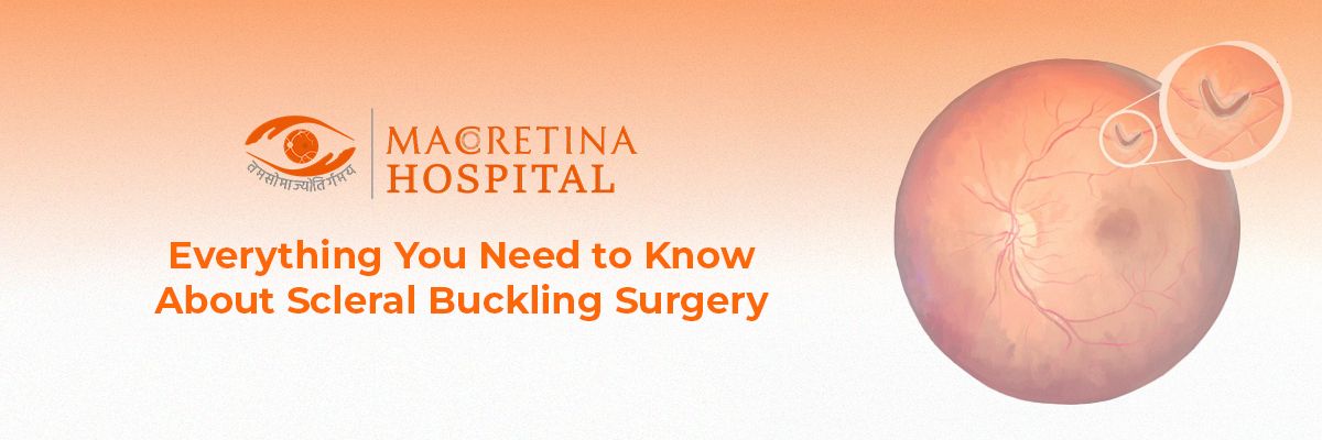 Everything You Need to Know About Scleral Buckling Surgery - Macretina ...